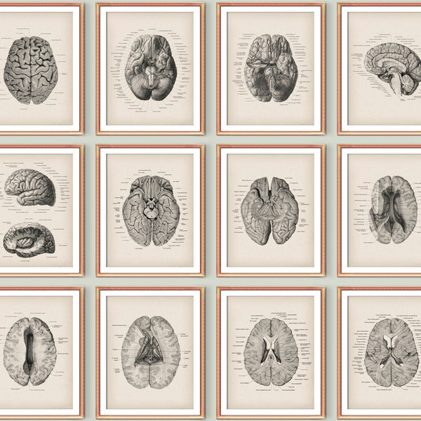 Brain Structure Poster - Etsy