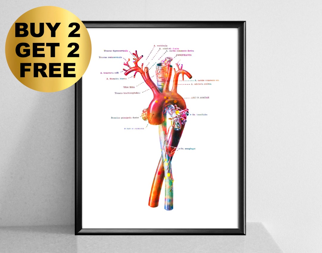 Abdominal Aorta Poster Aorta Anatomy Art Medical Anatomy Art Aortic ...