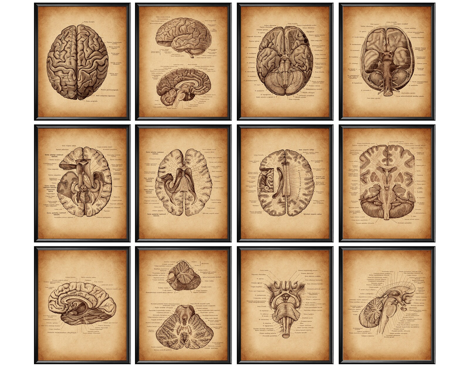 Vintage Brain Anatomy Poster Set 12 Anatomical Artwork - Etsy