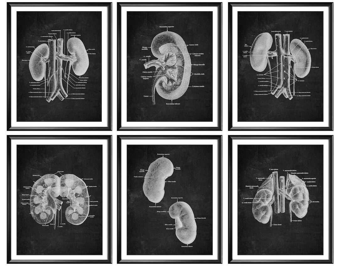 Kidney Anatomy Poster Set 6, Anatomy Art, Nephrology Art, Physiology ...