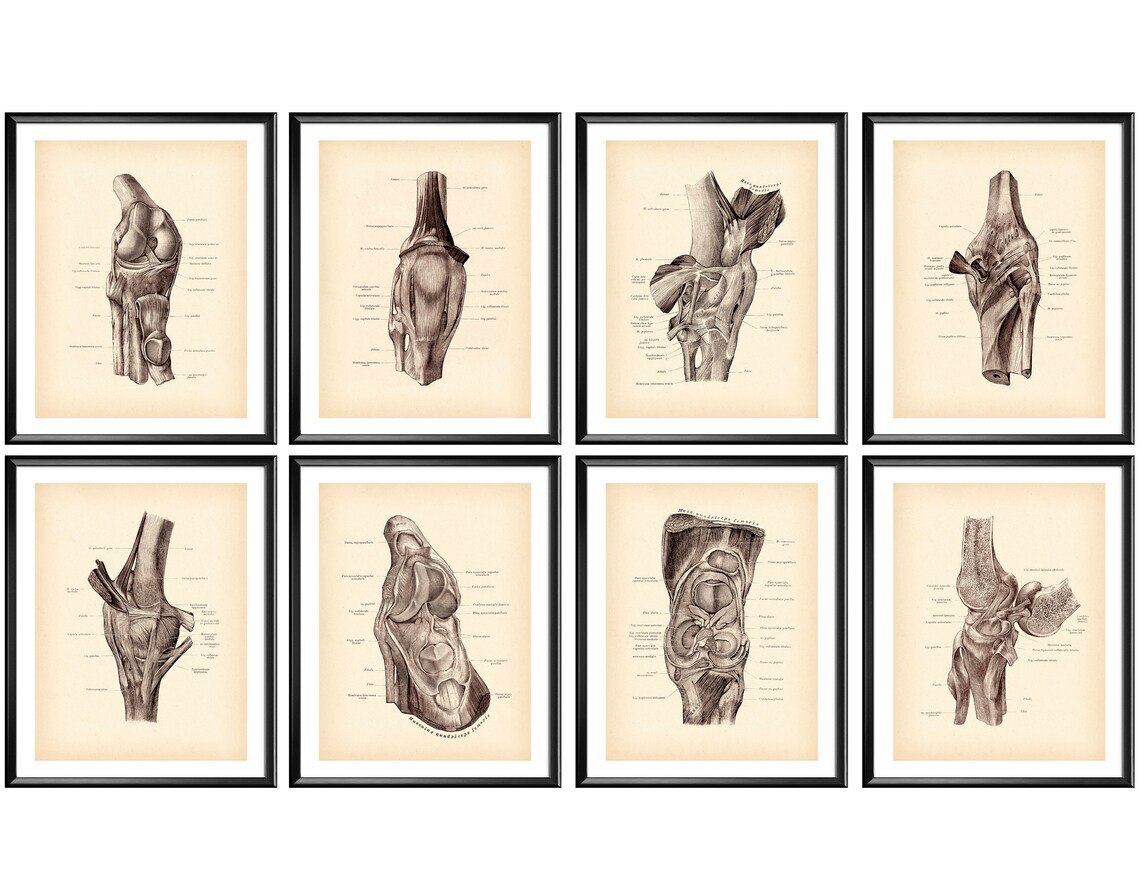 8 Knee Surgery Posters Vintage Anatomy Art Knee Join Poster - Etsy