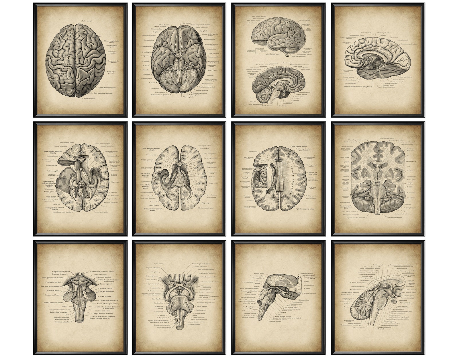 12 Medical Neurology Posters, Vintage Neuroscience Art, Human Brain ...