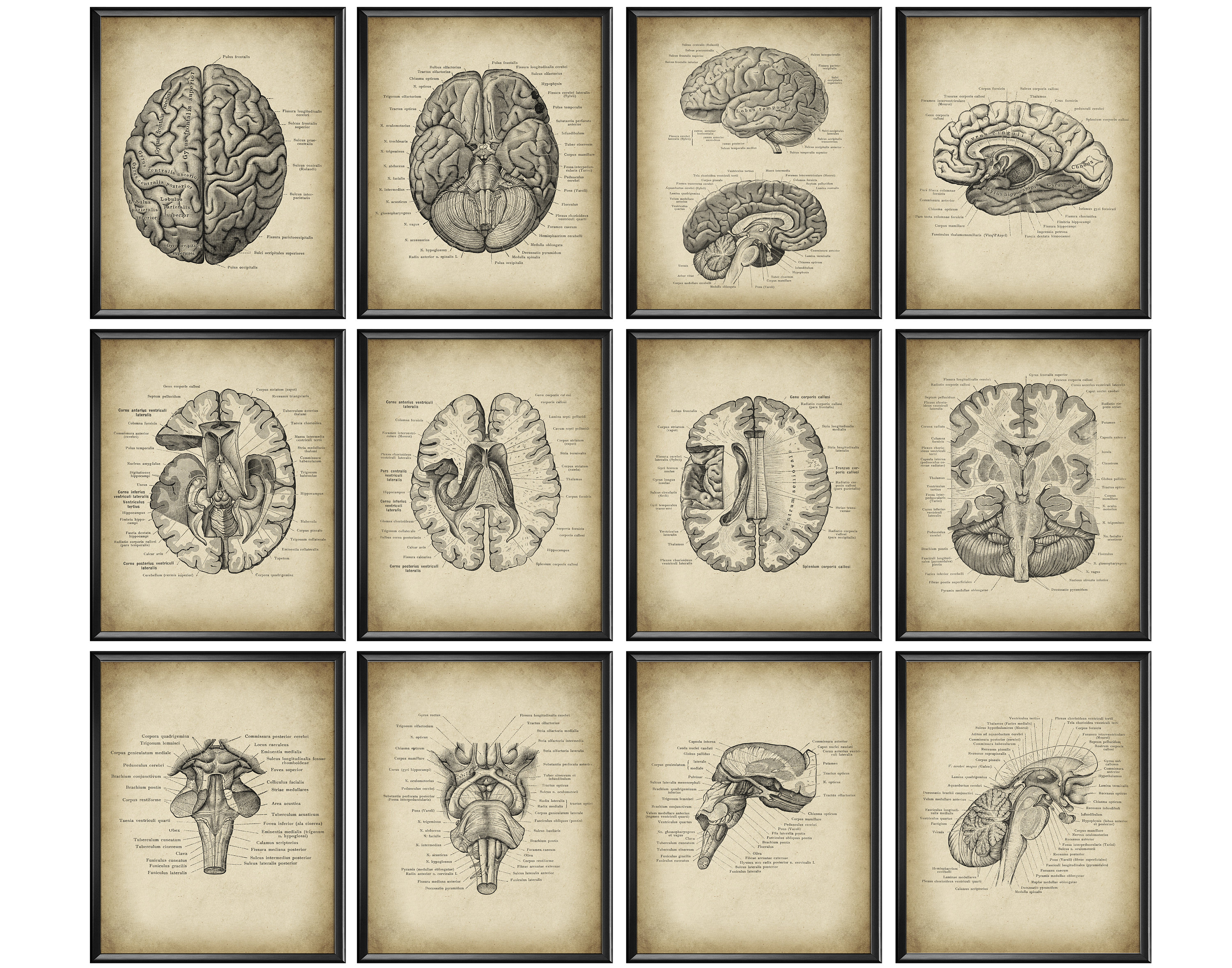 12 Medical Neurology Posters, Vintage Neuroscience Art, Human Brain ...