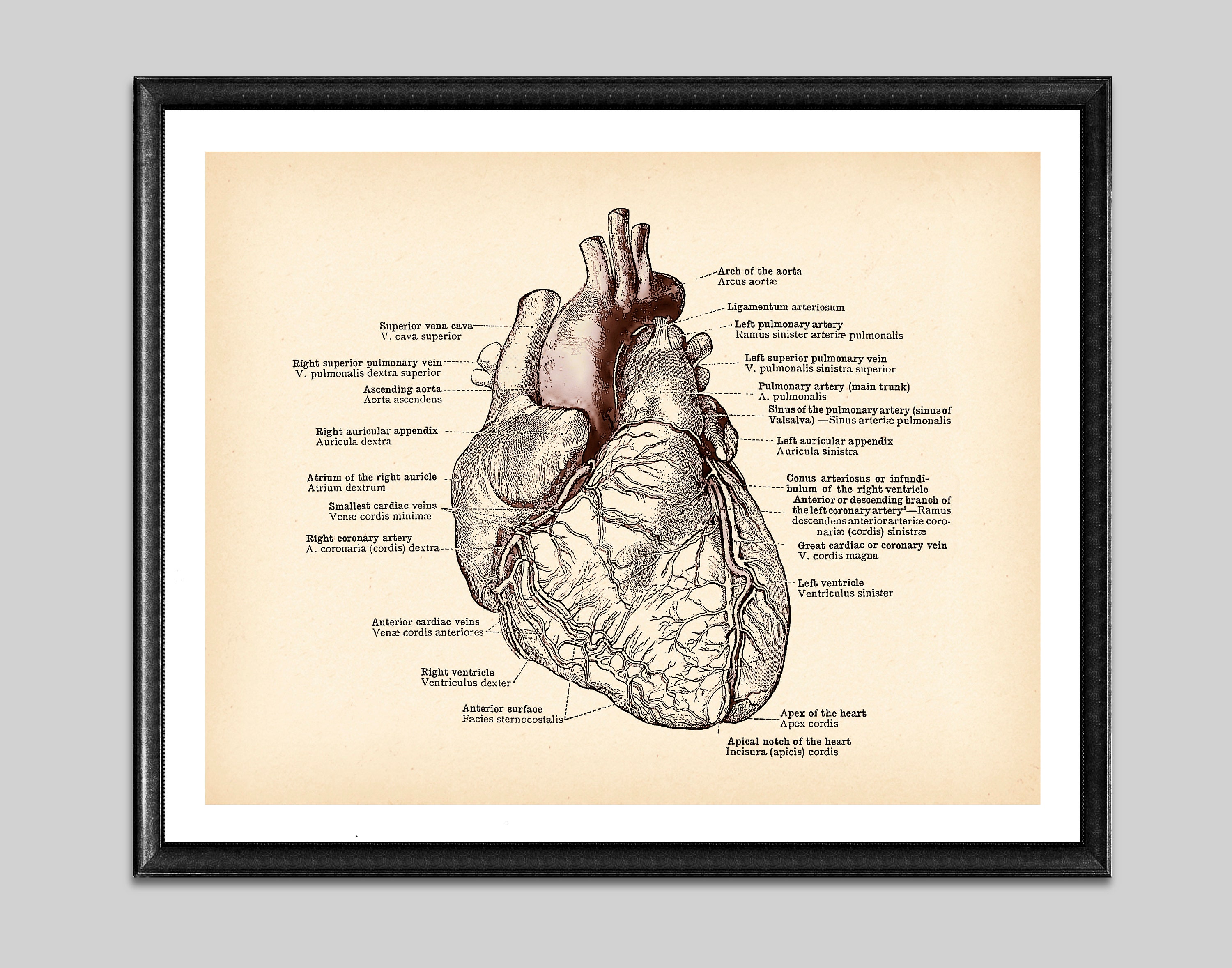 Human Anatomical Heart Vintage Poster Medical Art Antique - Etsy