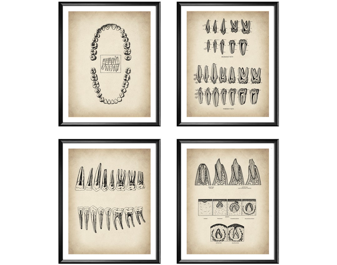 4 Vintage Dental Anatomy Posters Tooth Anatomy Art Tooth Growth Diagram ...