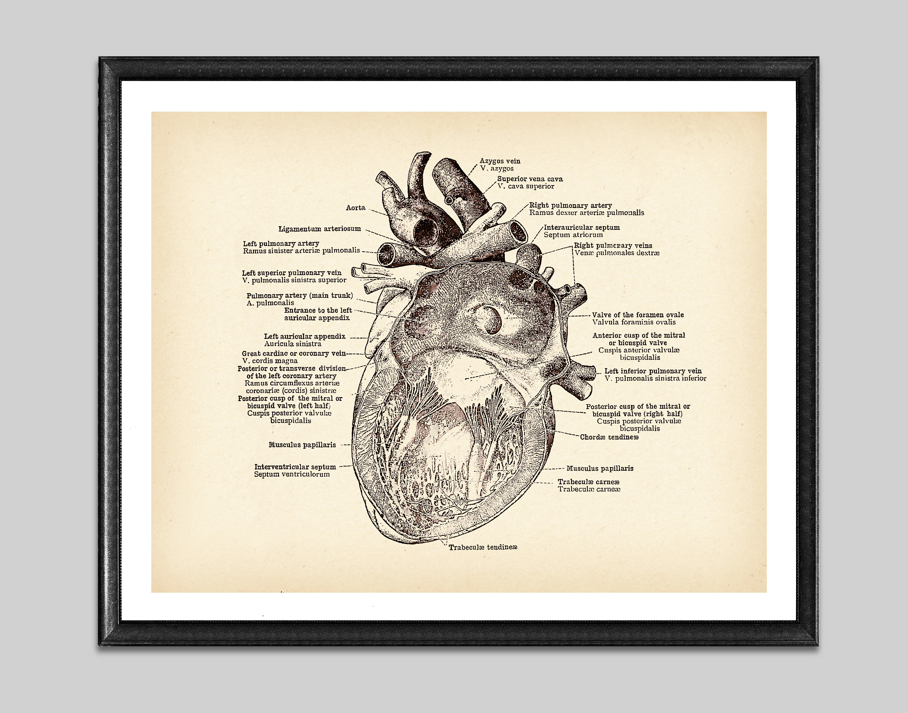 Human Anatomical Heart Vintage Poster Medical Art Antique | Etsy