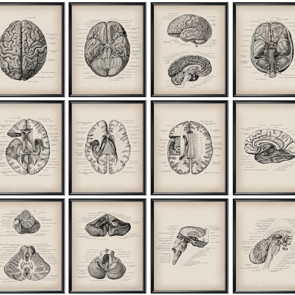 Vintage Brain Poster - Etsy