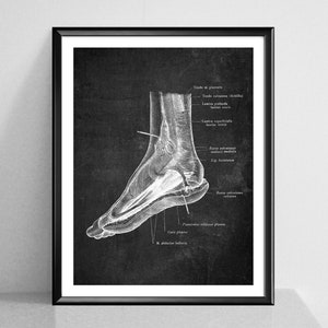 Foot Poster Bones and Muscles Anatomy Chalkboard Art Podiatry Art ...
