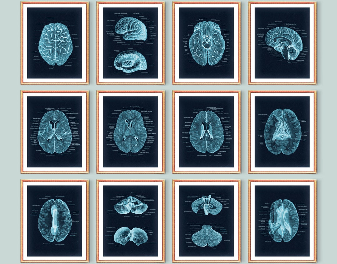 12 Neuroanatomy Art, Neurology Poster, Anatomical Brain Diagram, MRI ...