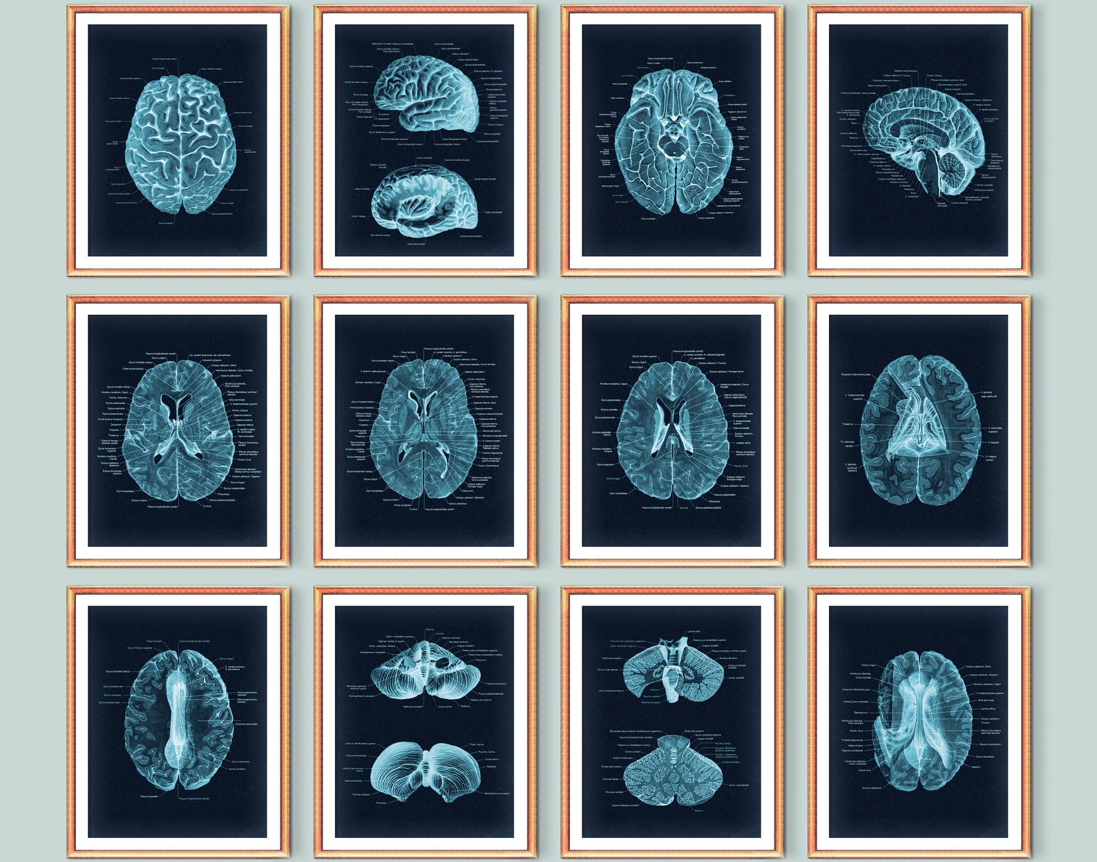 12 Neuroanatomy Art, Neurology Poster, Anatomical Brain Diagram, MRI ...