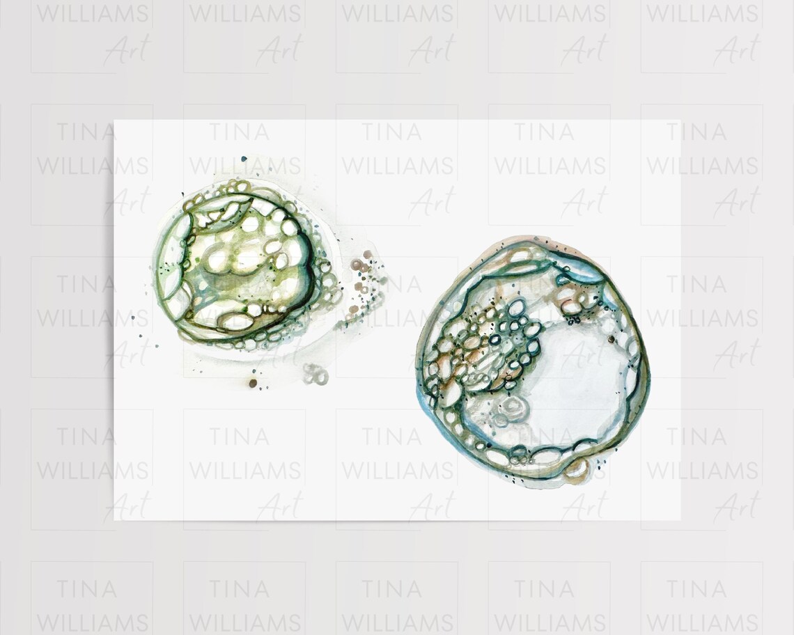 Custom Watercolor Embryo Art: Rainbow Baby Nursery Decor - Etsy