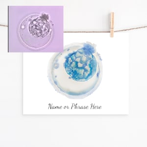 Custom Embryo Art - Nursery - Baby Shower Gift - New Baby - IVF ...