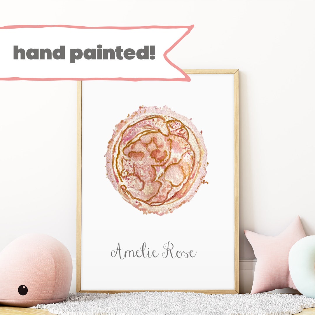Custom Embryo Art - Nursery - Baby Shower Gift - New Baby - IVF ...