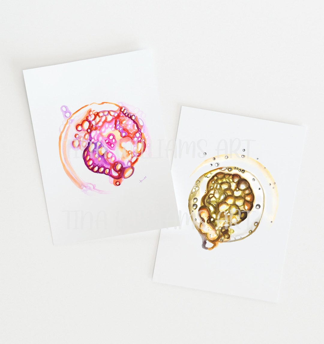 Custom Embryo Art - Nursery - Baby Shower Gift - New Baby - IVF ...