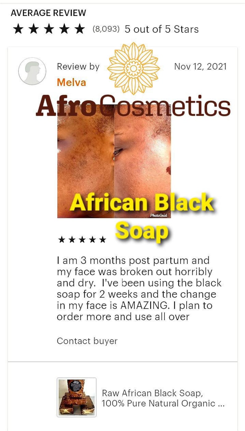 Raw African Black Soap 1 Lbs Bar 100 Pure Natural Organic Etsy