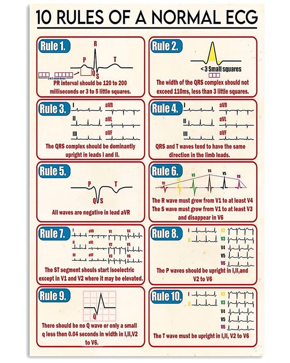 10 Rules Of A Normal Ecg Poster Home Decor Wall Art Print Gift Etsy 10 Rules Of A Normal Ecg Poster Home Decor Wall Art Print Gift Etsy