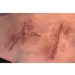 Stitched Wound Prosthetic, Stitches, SFX Makeup, Silicone Appliance ...