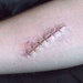 Stitched Wound Prosthetic, Stitches, Gore, SFX Makeup, Silicone ...