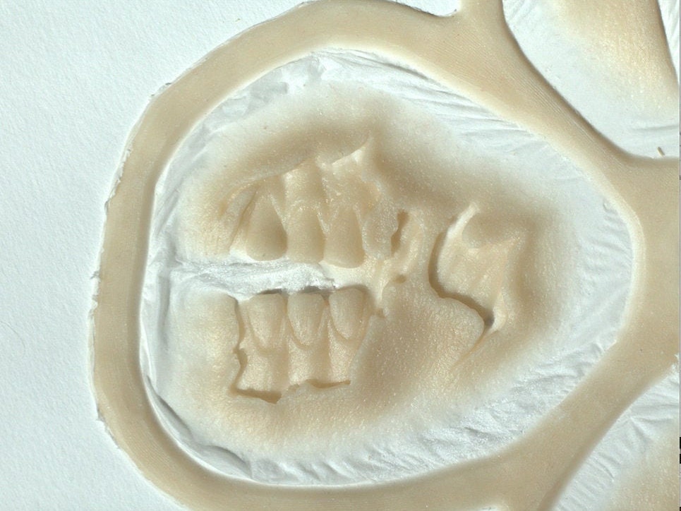 Zombie Mouth/jaw Exposed Teeth Prosthetic SFX Makeup - Etsy UK