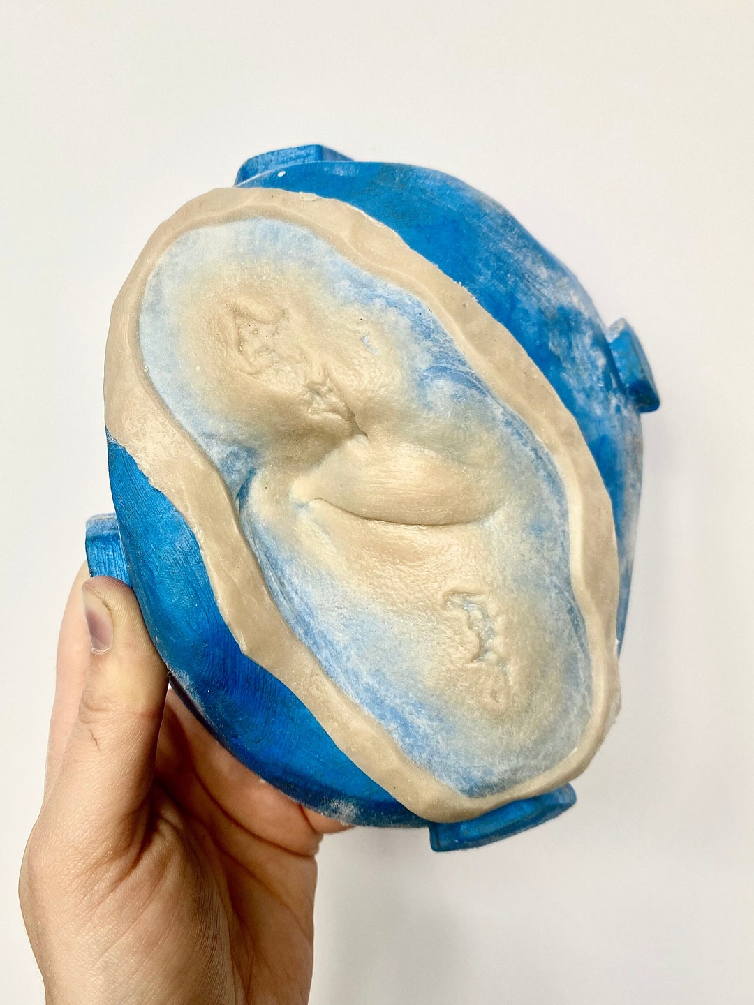 Swollen Black Eye Trauma Prosthetic, Encapsulated Silicone Prosthetic ...