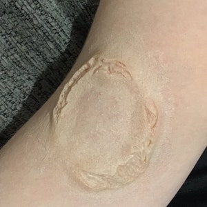 Zombie Bite Wound Prosthetic SFX Makeup Silicone Appliance - Etsy UK