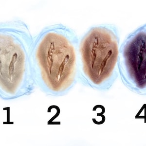 Stitched Wound Prosthetic, Stitches, Gore, SFX Makeup, Silicone ...