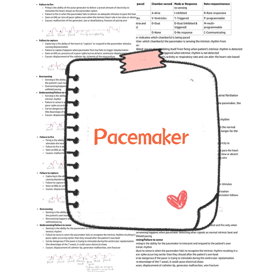 Pacemaker Nursing Note, Study Guide - Etsy