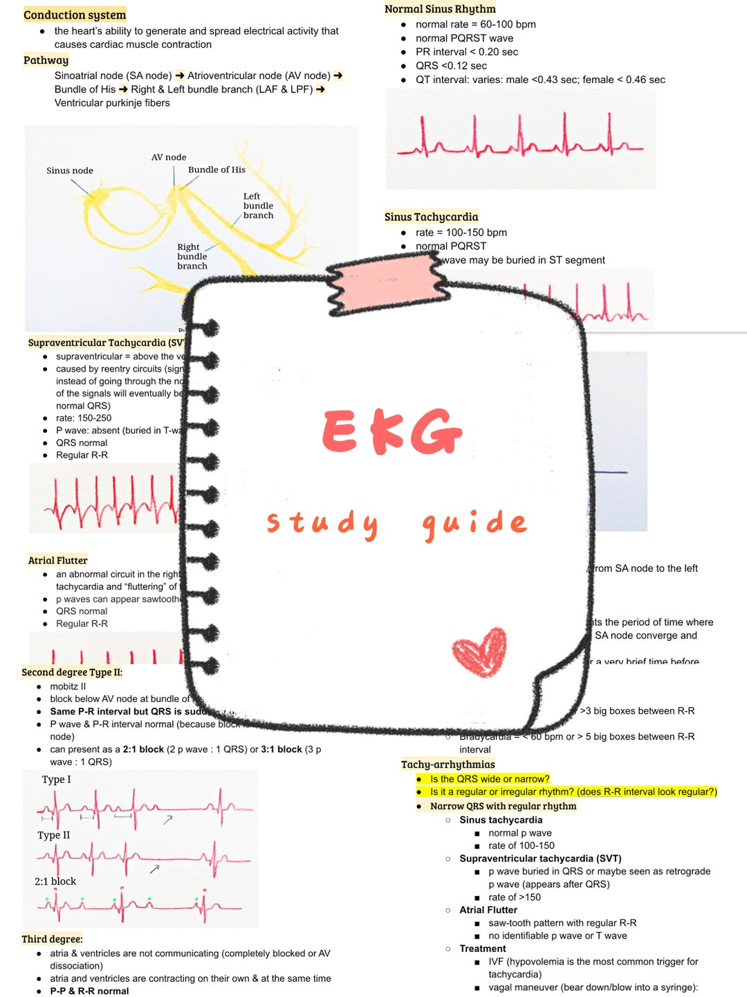 EKG Study Guide, Cheat Sheet, Nursing Study Guide, Nursing Student ...