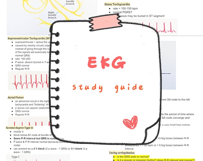 Printable Impella Cheat Sheet Cath Lab Nurse Sheet - Etsy Hong Kong