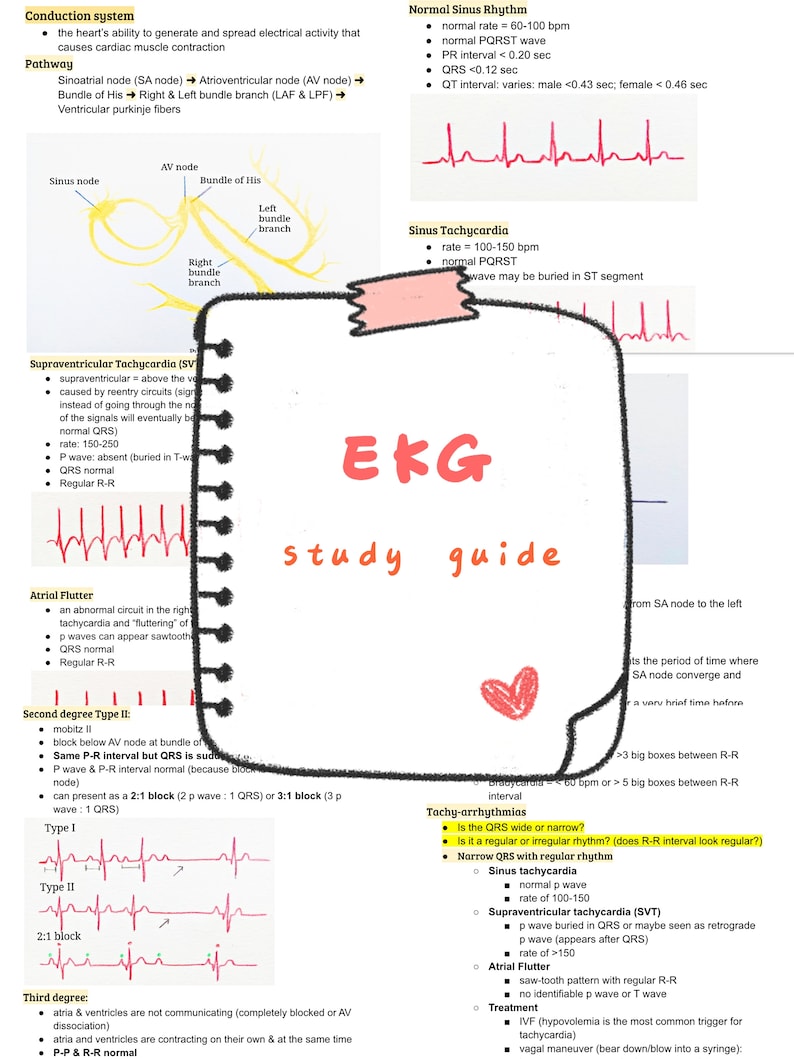 EKG Study Guide, Cardiac Nursing, Fundamentals Nursing, Nursing ...