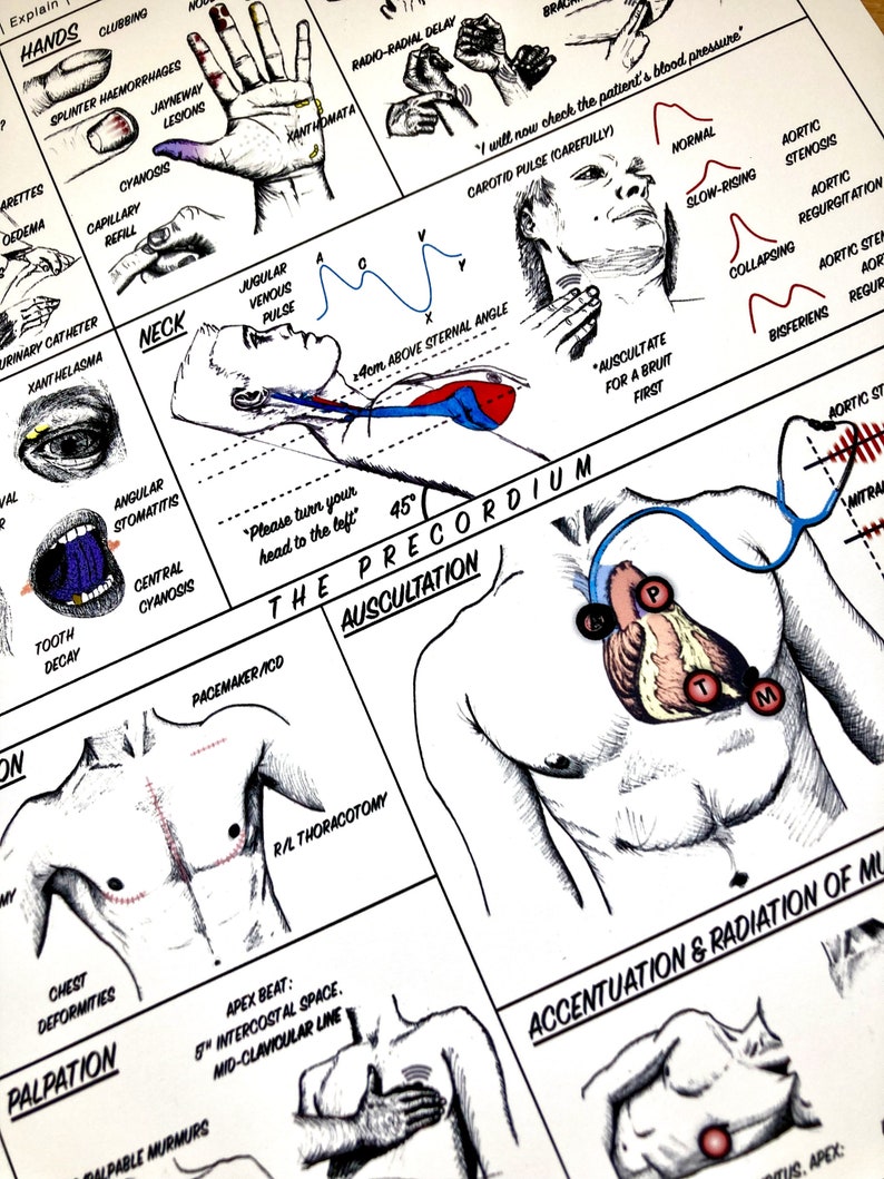 Clinical Examination OSCE Study Guide (A4 Matte Poster) - Etsy