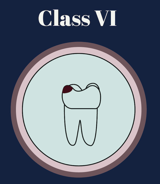Tooth Numbering System Diagram Svg Png Jpeg Ai Pdf Dental Dentistry Jaw ...
