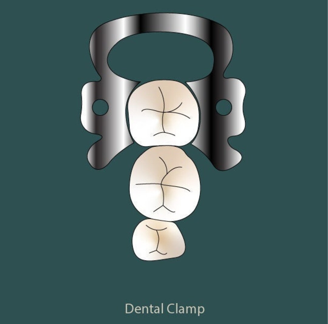 Dental Charting Guide, Teeth Parts Guide Charting, Dental Student ...