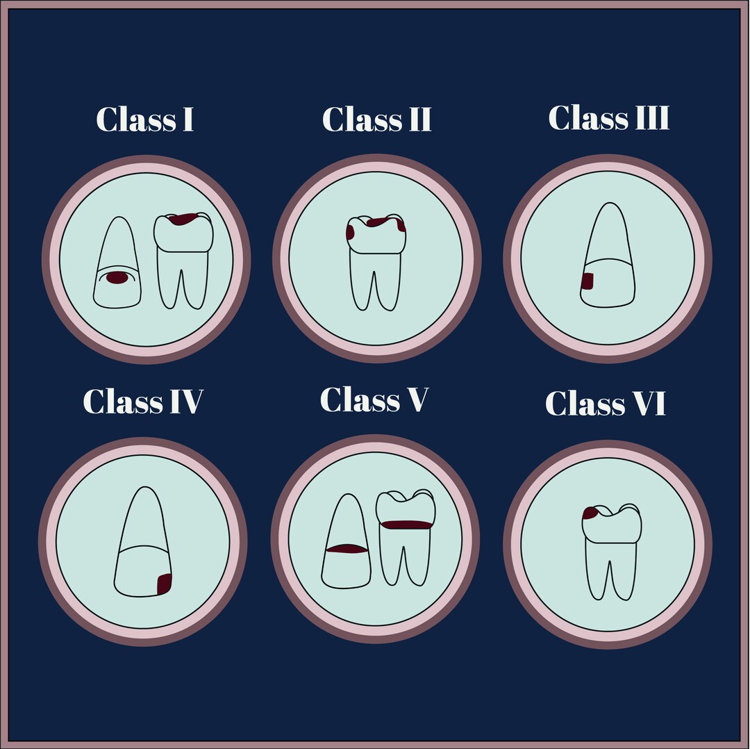 Tooth Numbering System Diagram Svg Png Jpeg Ai Pdf Dental Dentistry Jaw ...