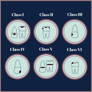 Tooth Numbering System Diagram Svg Png Jpeg Ai Pdf Dental Dentistry Jaw ...