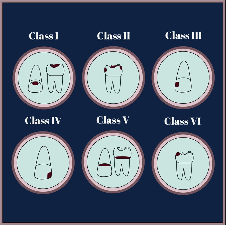 Tooth Numbering System Diagram Svg Png Jpeg Ai Pdf Dental Dentistry Jaw ...