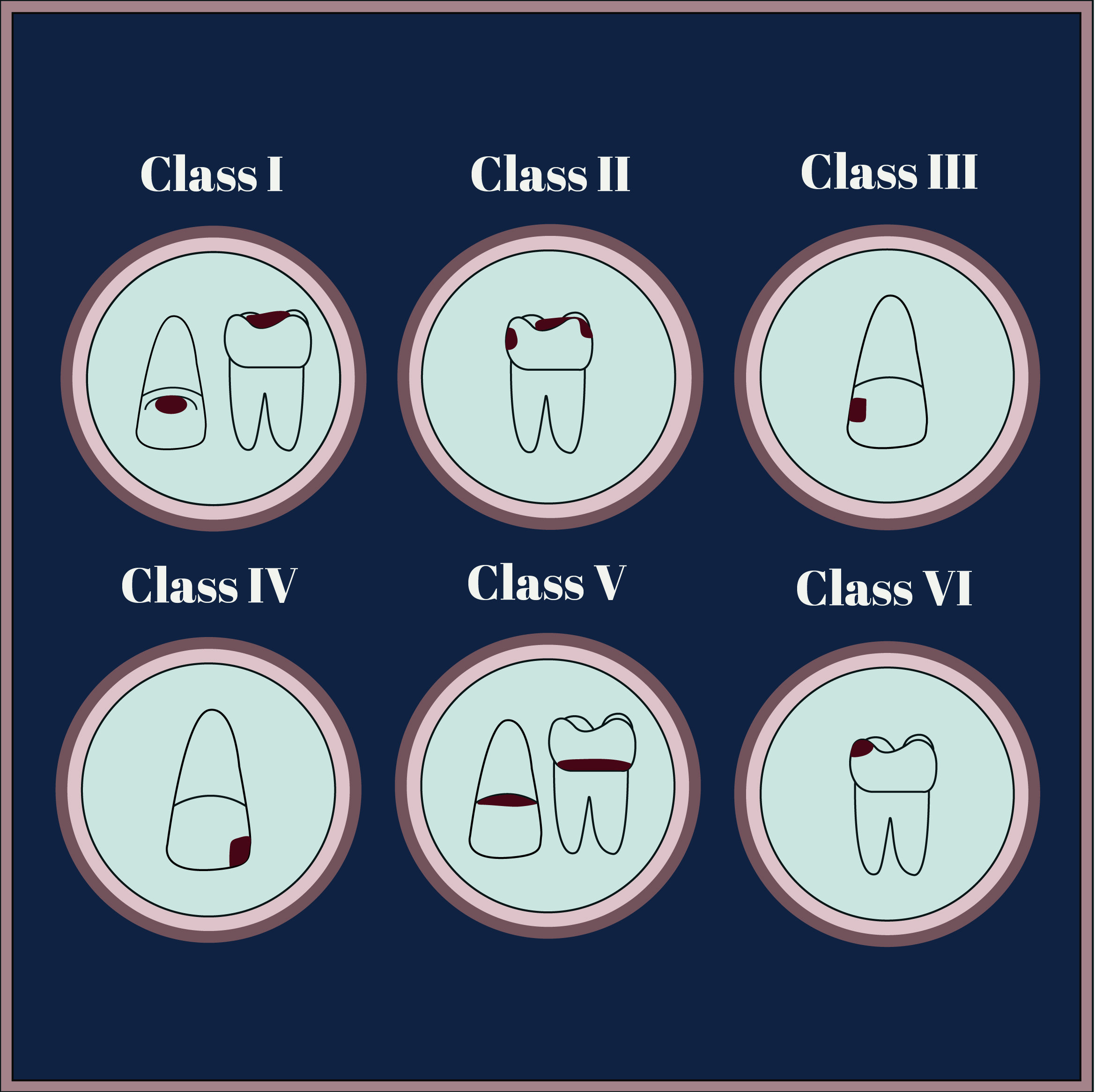 Tooth Numbering System Diagram Svg Png Jpeg Ai Pdf Dental Dentistry Jaw ...