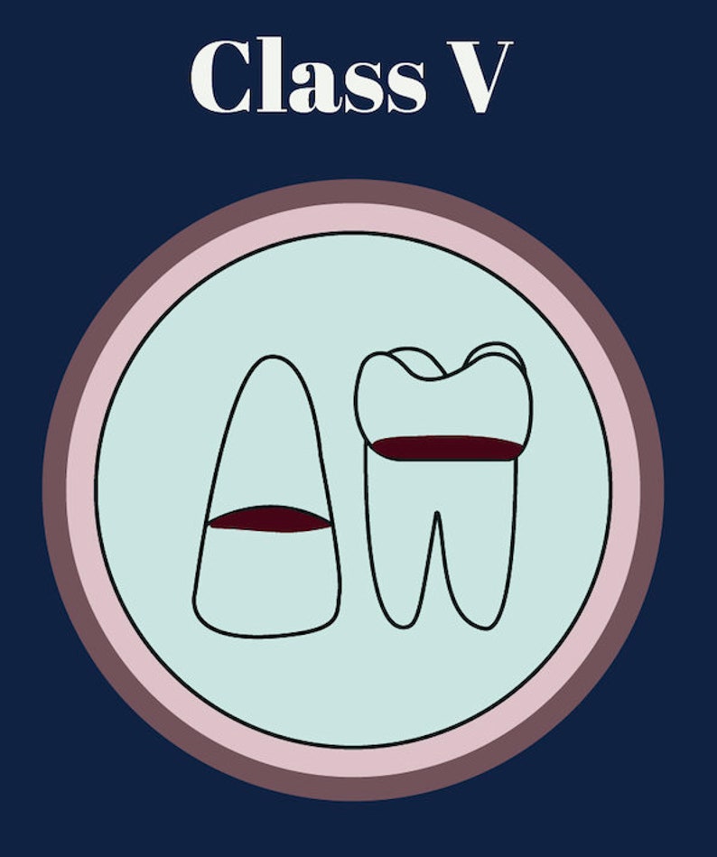 Tooth Numbering System Diagram Svg Png Jpeg Ai Pdf Dental Dentistry Jaw ...