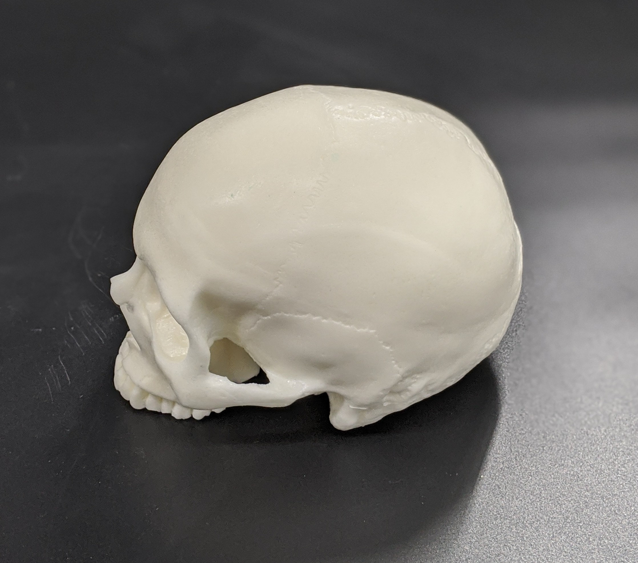 Self-healing Skulls | Etsy