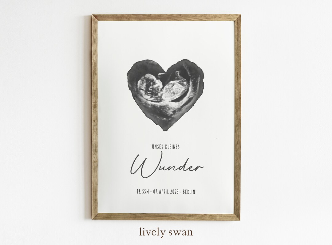 Poster Ultrasound Image Personalized, Announce Pregnancy, Baby Room ...