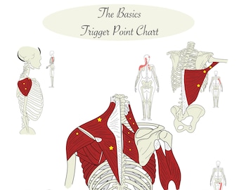 Lower Body - Trigger Point Chart - Muscle Anatomy Art - Chiropractic ...