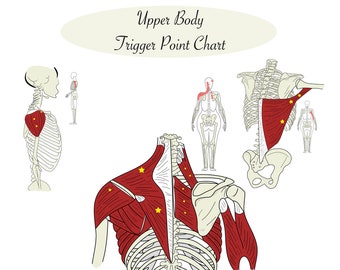 Lower Body - Trigger Point Chart - Muscle Anatomy Art - Chiropractic ...