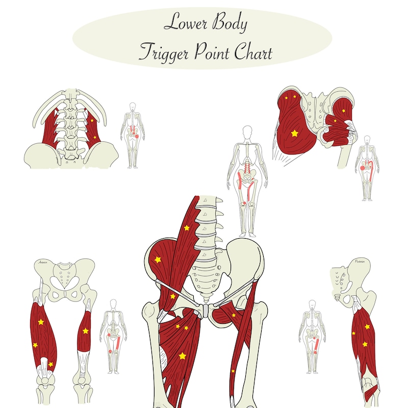 Muscle Trigger Point Chart - Etsy