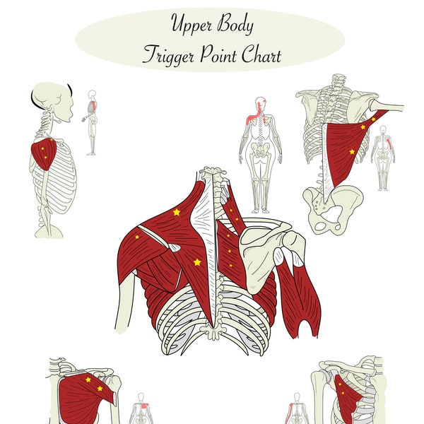 Muscle Trigger Point Chart - Etsy