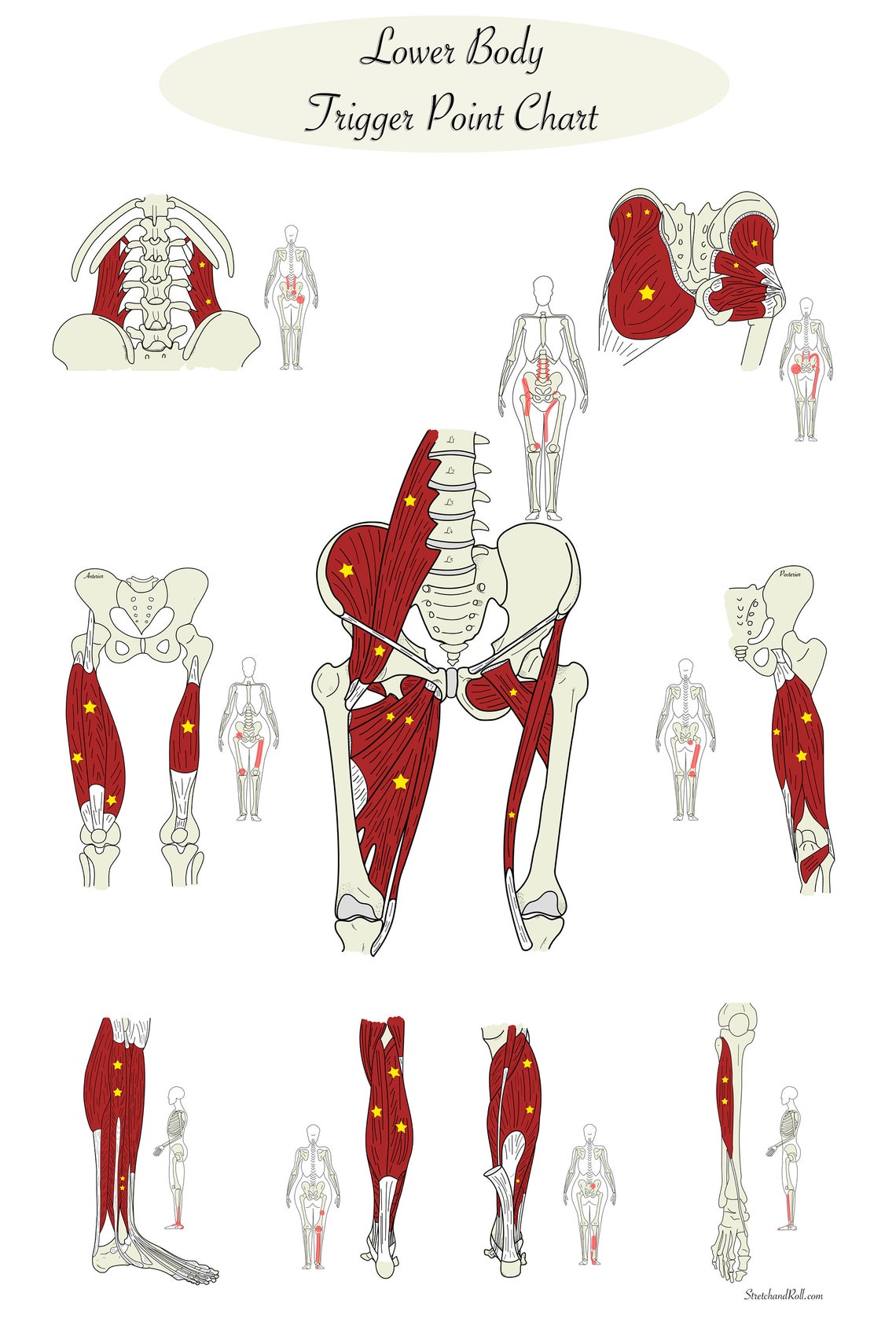 Lower Body - Trigger Point Chart - Muscle Anatomy Art - Chiropractic ...