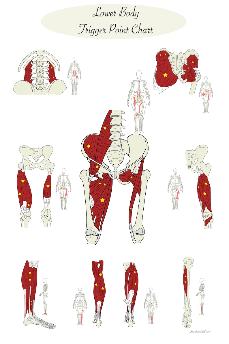 Lower Body - Trigger Point Chart - Muscle Anatomy Art - Chiropractic ...
