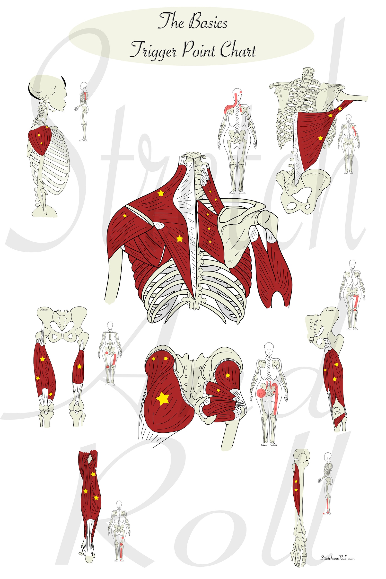 Lower Body - Trigger Point Chart - Muscle Anatomy Art - Chiropractic ...