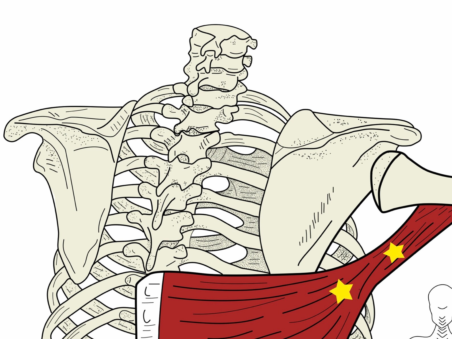Upper Body - Trigger Point Chart - Muscle Anatomy Art - Chiropractic ...