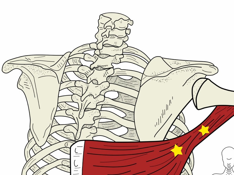 Upper Body - Trigger Point Chart - Muscle Anatomy Art - Chiropractic ...