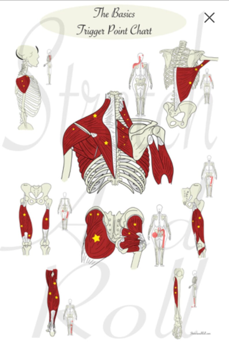 Upper& Lower Body Trigger Point Chart Bundle - Muscle Anatomy Art ...